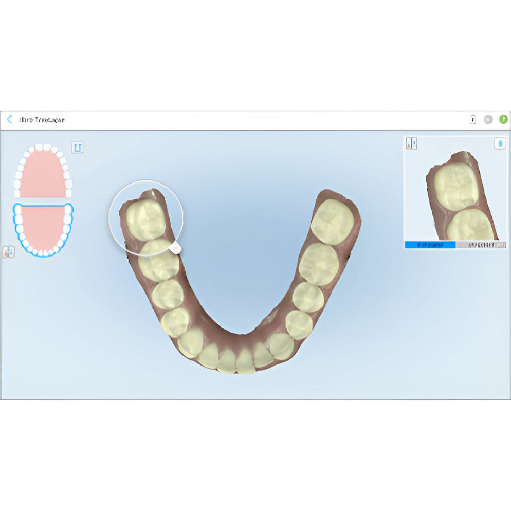 iTero Element 2 Dental Scanner with 1-Year Warranty | BuyDirect & Save